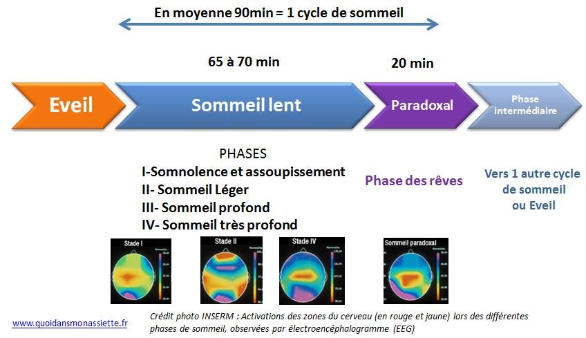 Retard de phase de sommeil Décalage de phase du sommeil